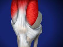 Mini Incision Total Knee Replacement - KOC Ortho