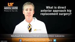 Direct Anterior Hip Replacement - Dr. Michael Eilerman - KOC Ortho